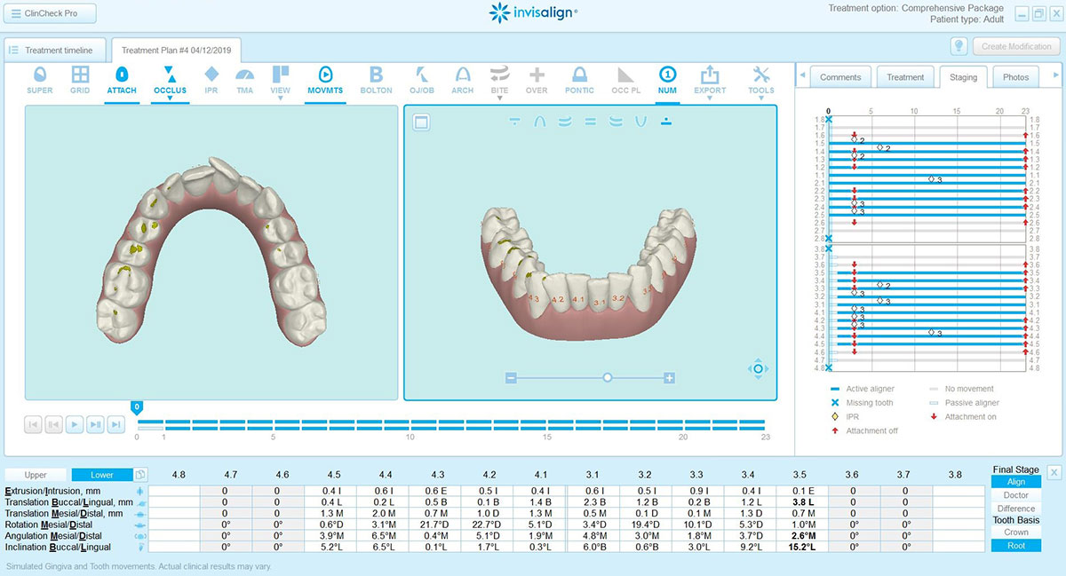 International Health Center | Invisalign | Record Taking | Milan, Italy ...