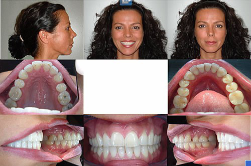 International Health Center | Invisalign | Record Taking | Milan, Italy ...